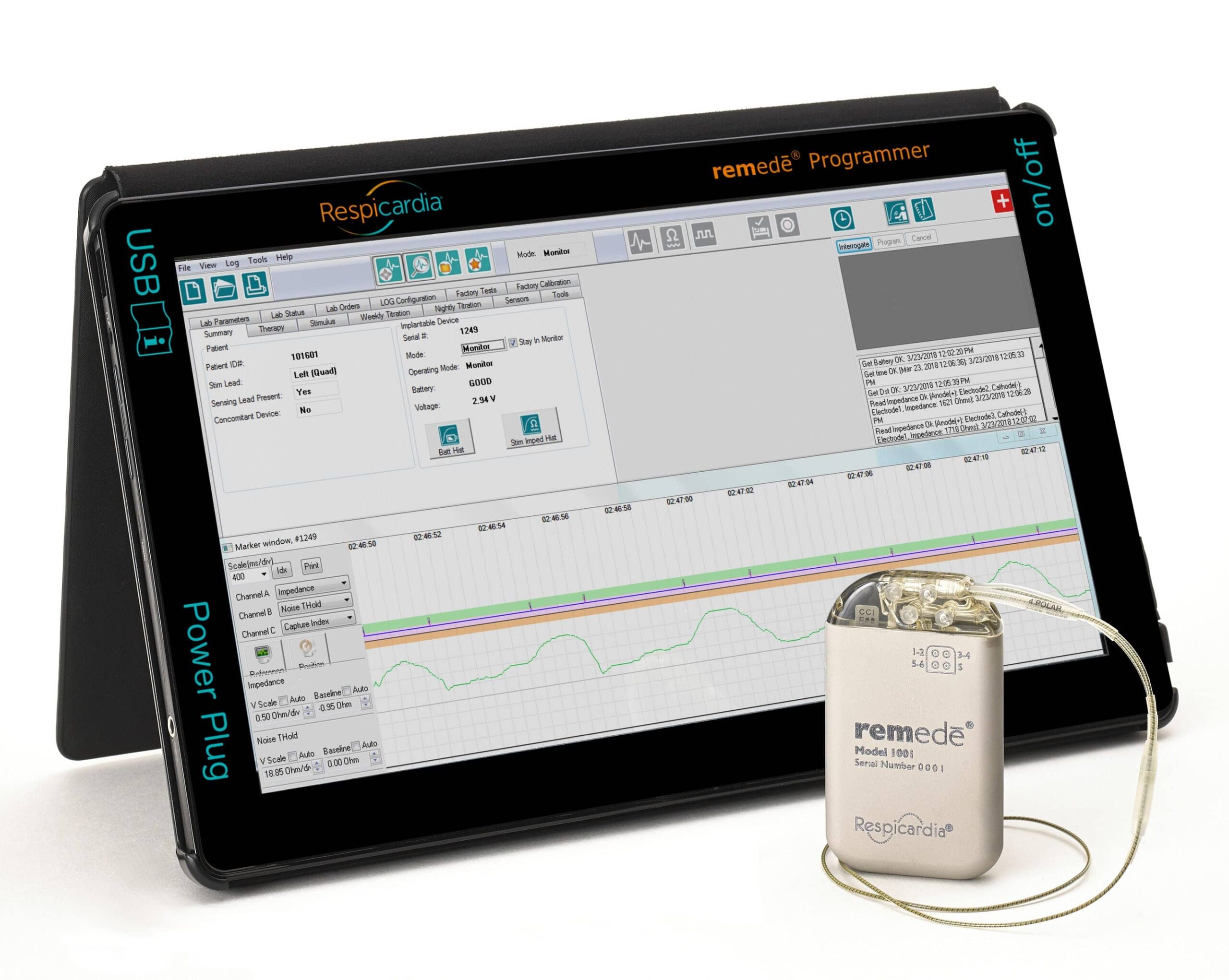 Remedē Shows Sustained Safety & Efficacy Through 5 Years | Sleep Review