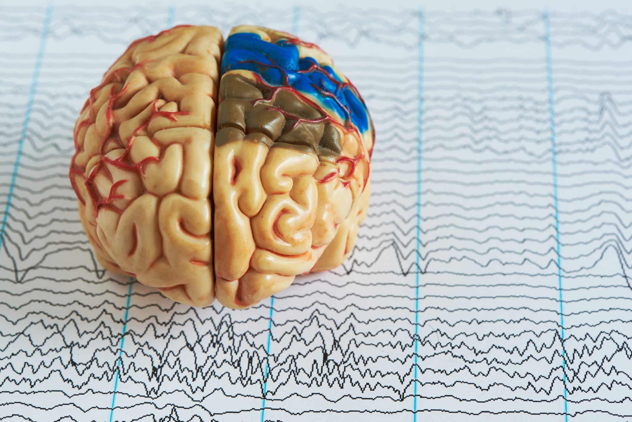 Cerebra Launches MY ORP to Enhance EEG-Based Sleep Studies | Sleep Review